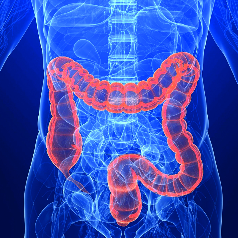 Rektum Kanseri – Asya Hastanesi